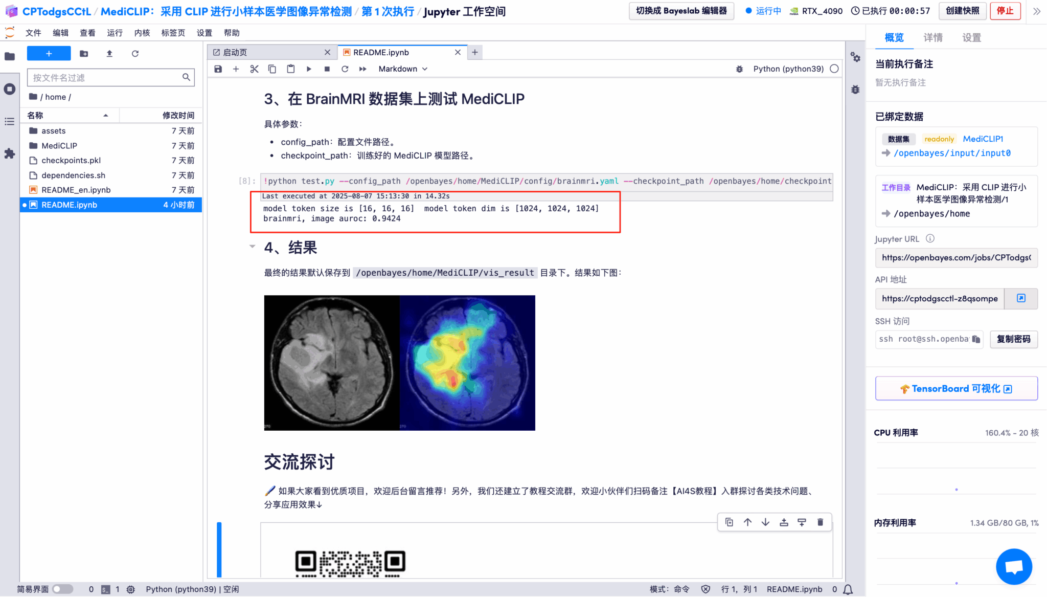在线教程丨仅需极少量医学影像数据，MediCLIP 在异常检测与定位任务中刷新 SOTA | 资讯 | HyperAI超神经