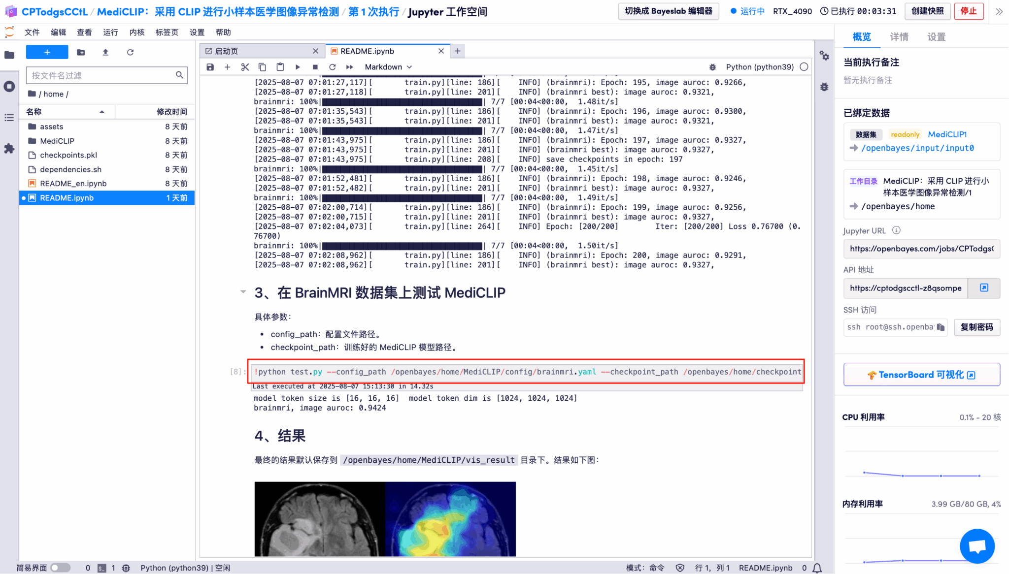 在线教程丨仅需极少量医学影像数据，MediCLIP 在异常检测与定位任务中刷新 SOTA | 资讯 | HyperAI超神经