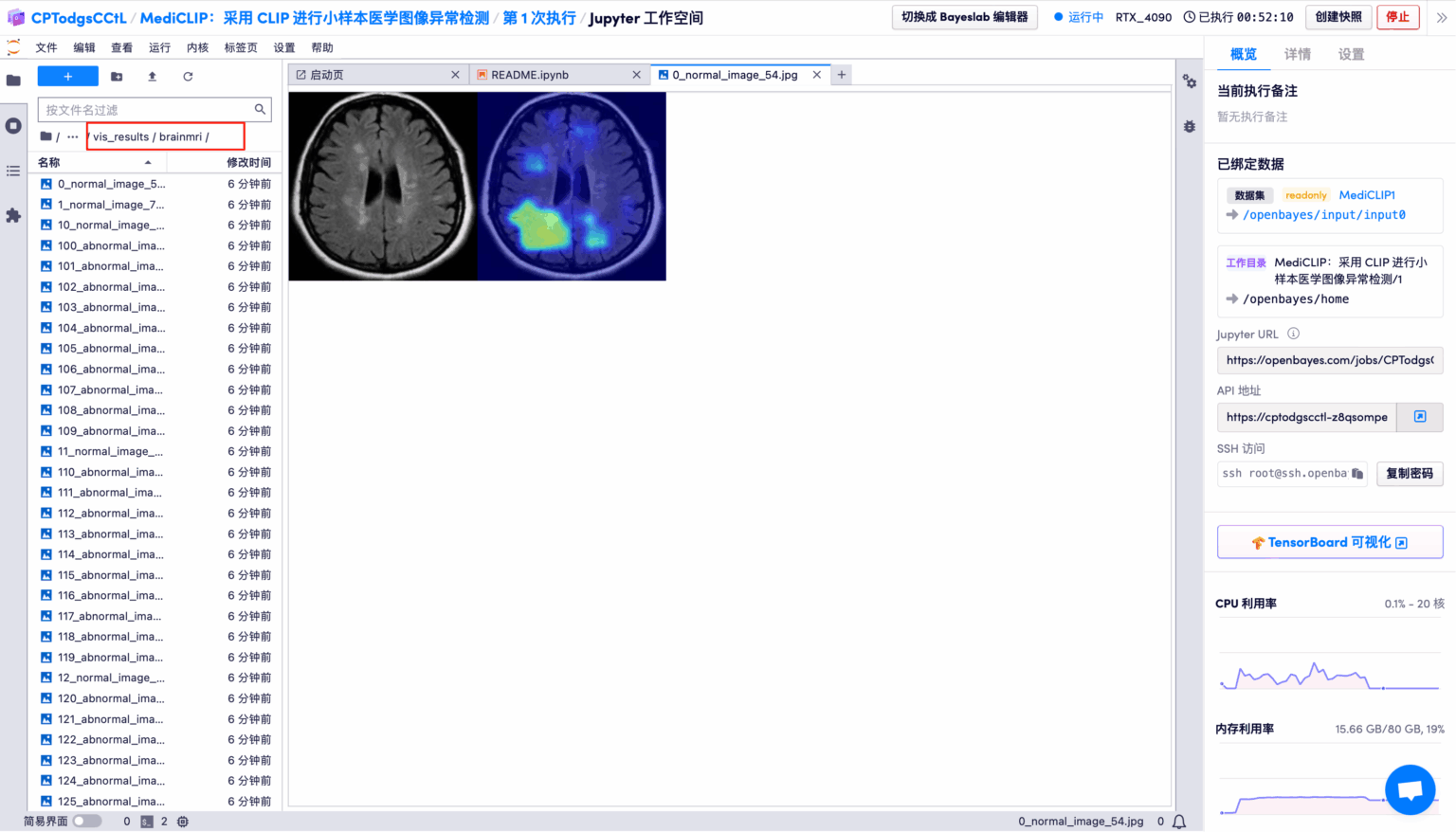 在线教程丨仅需极少量医学影像数据，MediCLIP 在异常检测与定位任务中刷新 SOTA | 资讯 | HyperAI超神经