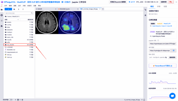 在线教程丨仅需极少量医学影像数据，MediCLIP 在异常检测与定位任务中刷新 SOTA | 资讯 | HyperAI超神经